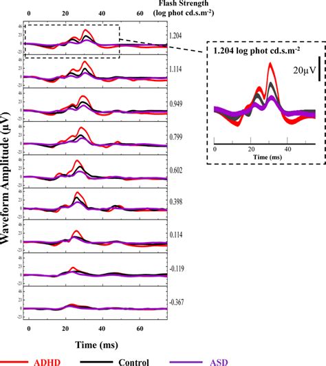 Comparison Of The Representative Light Adapted Erg Waveforms Of One Download Scientific Diagram