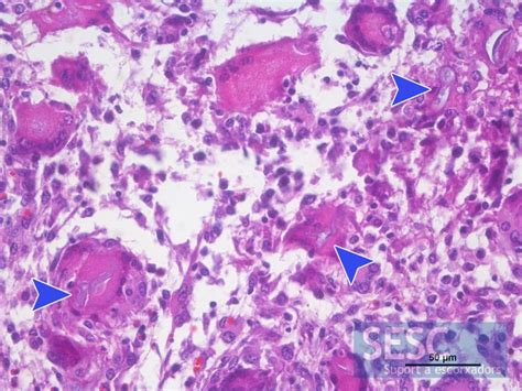 Mucor Histology
