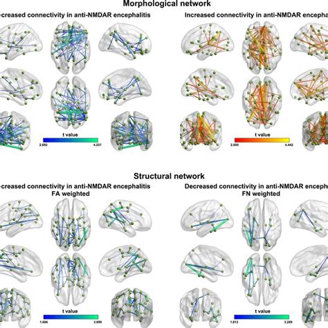 Brain Network‐based Classification Of The Patients The Mean