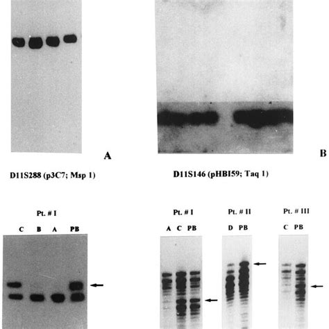 Representative RFLP Analysis Patients I II III And IV And Glands Download Scientific
