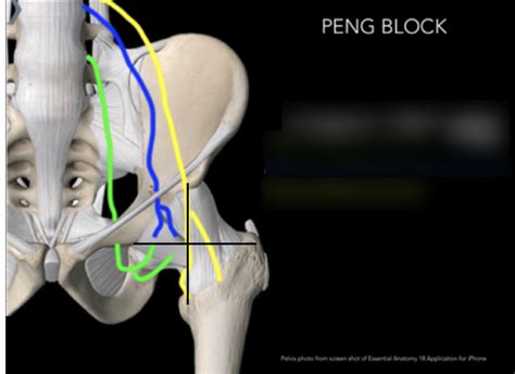 Regional Exam 2 Focus On Peng Block Nerves And Their Definitions