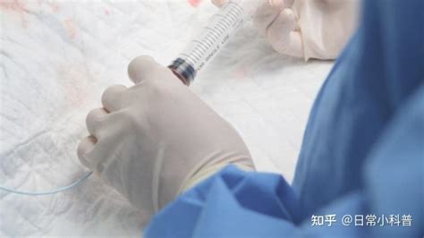 62岁大叔因长期喝热茶患了食道癌！祸从口入的食管癌该怎么治疗？ 知乎