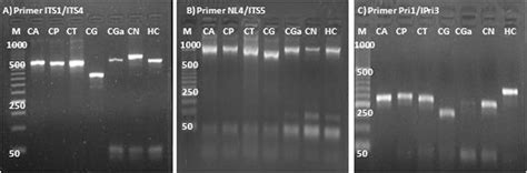 Pcr Products Obtained With Primers Its1its4 A Nl4its5 B And