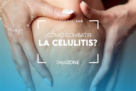 ¿cómo Combatir La Celulitis Depilzone