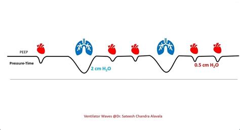 Jemal Kasim On Linkedin False Trigger And Failed Trigger Simplified Pic
