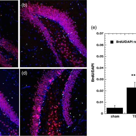 Brdu Neun Double Staining Images And Analyses At The Neurogenic Download Scientific Diagram