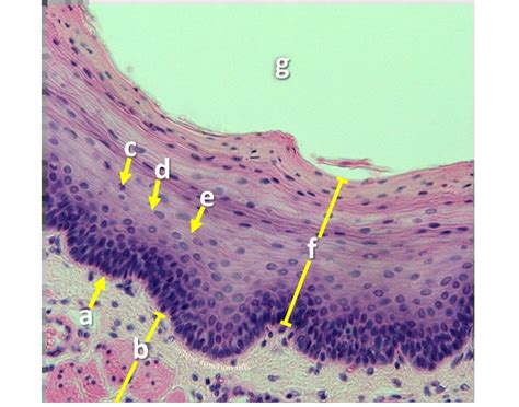 Non Keratinized Stratified Squamous Epithelium Quiz