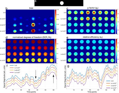 A Single Slice Phantom Signal Simulation Sim2 Green And Red