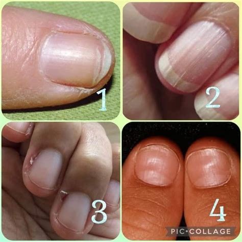 【happy Арьс үс хумсанд гарч байгаа өөрчлөлтүүд нь бидний биед зарим