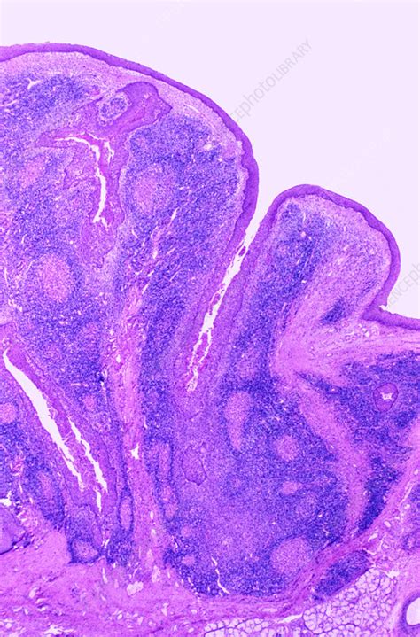 Human Palatine Tonsil Light Micrograph Stock Image C0626106