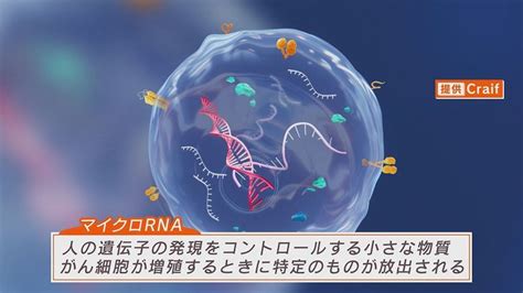 尿でわかる北海道のがん死亡率は3年連続で全国ワースト2位 次世代のがんリスク検査とはSitakkeしたっけ