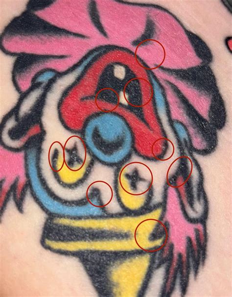 Year Old Tattoo Itchy And Bumpy Burning Upon Touch Rtattooadvice