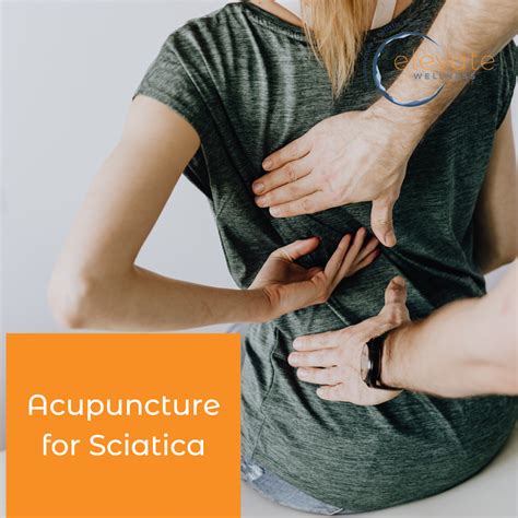 Acupuncture For Sciatica Acupuncture In St Petersburg Fl