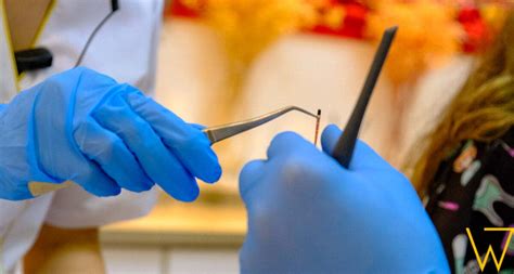 Teeth Diseases W Clinics Health