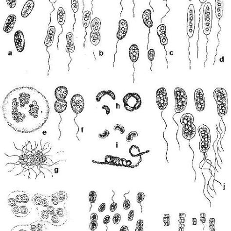 A C — Thiothrix Nivea A B — 1000 X C — 60 X D — Thiothrix