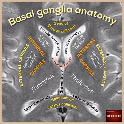 Basal Ganglia Sagittal View