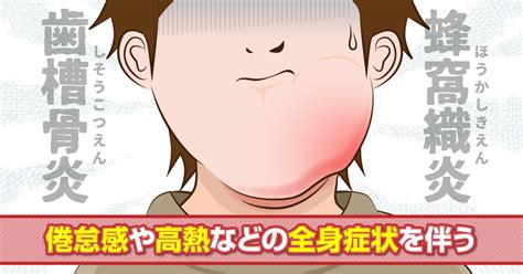 根っこの先に膿の袋ができる？「根尖病巣（こんせんびょうそう）」とは ｜ ウニクス成田歯科ブログ ウニクス成田歯科 成田市はなのき台