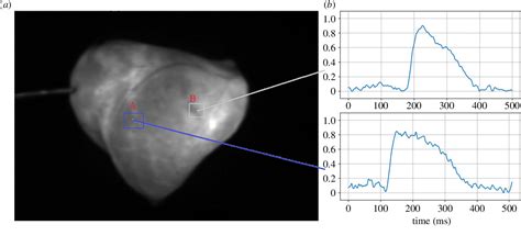 Figure 4 From Simultaneous Data Assimilation And Cardiac Electrophysiology Model Correction