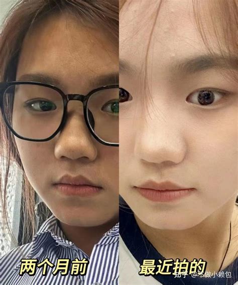皮肤暗沉发黄怎么改善？ 知乎