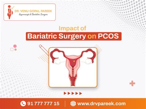 Impact Of Bariatric Surgery On Pcos Bariatric Surgeon India