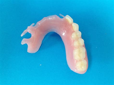 Thermosens Partial Flexible Dentures Denture Professionals Rockingham