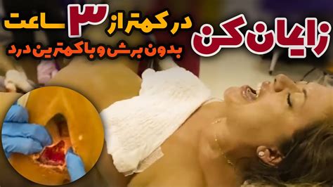 کاهش درد زایمان طبیعی با آبزن گیاهی باز شدن دهانه رحم برای زایمان و