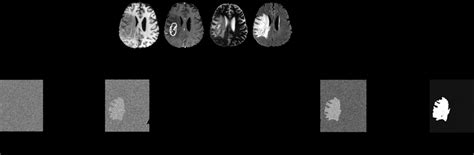 The Training And Sampling Procedure Of Our Method In Every Step T The