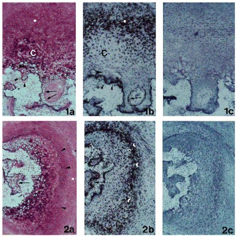 Endochondral Bone Formation In The Developing Osteophyte Serial Download Scientific Diagram