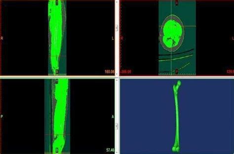 Segmented Models Of Ct Scan Download Scientific Diagram