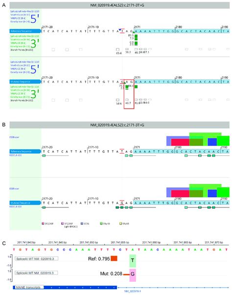 In Silico Prediction Of The Als2 C 2171 3t G Variant A In Silico