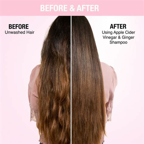 Apple Cider Vinegar For Hair Growth