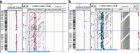 Array Cgh Analysis Showing A Deletion Of Approximately 15 Mb That