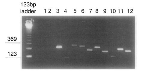 Differentially Displayed Cdna Fragments Excised From Dried