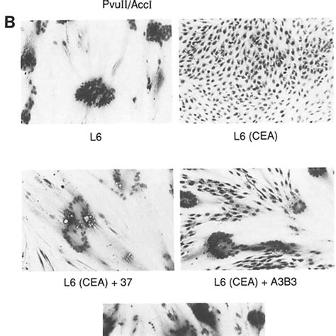 a depiction of cdnas and corresponding protein domains for cea and