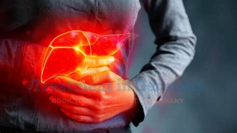 Understanding Ascites As A Symptom Of Liver Cancer