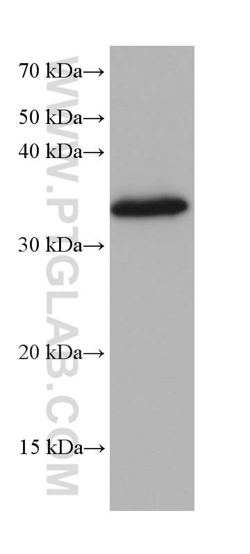Ppa2 Antibody 68468 1 Ig Proteintech