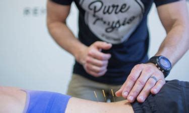 Dry Needling Pure Physio Physical Therapy Clinic Strongsville Oh