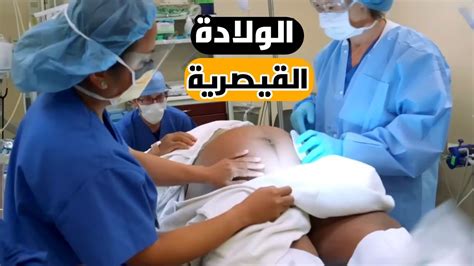 شاهد الولادة القيصرية كأنك تراها في الحقيقة Cesarean Section Operative Technique Youtube