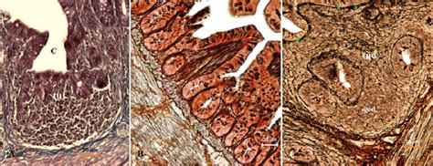 Microscopic Imaging Of Ileum And Proximal Cecum A Microscopic