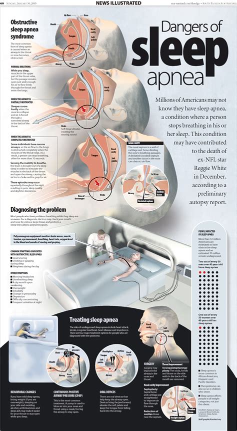 Sleep Apnea Dangers Artofit