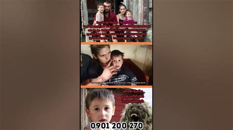 უზარმაზარმა გაცოფებულმა კავკასიურმა ნაგაზმა ბავშვს თავში კბილები ჩაავლო