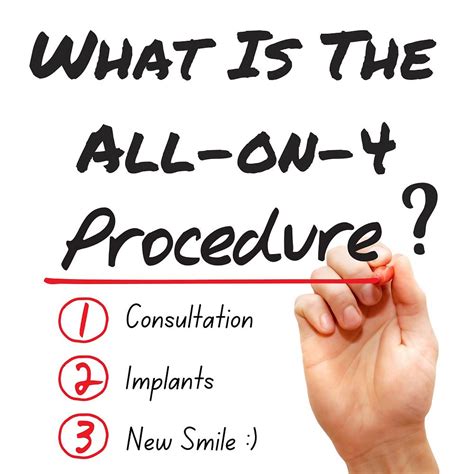 Kelly Vaughn On Linkedin What Is The All On 4 Procedure