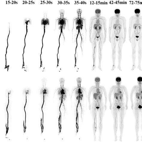 Maximum Intensity Projections Of Selected Dynamic Reconstructed Images