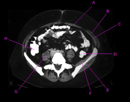 CT Female Reproductive Flashcards Quizlet