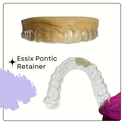 Essix Retainers Your 2024 Guide To Clear And Pontic Retainers
