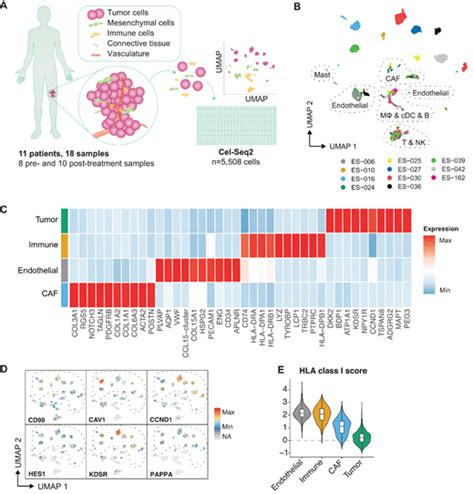 Ewing Sarcoma Single Cell Transcriptome Analysis Reveals Functionally