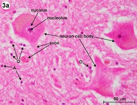 How Can Astrocytes And Oligodendrocytes Be Distinguished In This