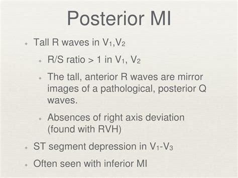 Ppt Ecg Interpretation Criteria Review Powerpoint Presentation Free