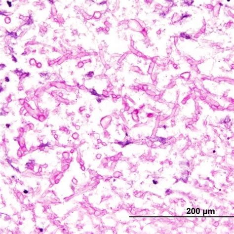 Macroscopic Appearance Of Pithomyces Chartarum On Sabouraud Dextrose