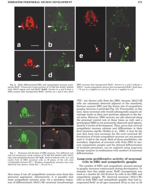Solved Zebrafish Peripheral Neuron Development Another